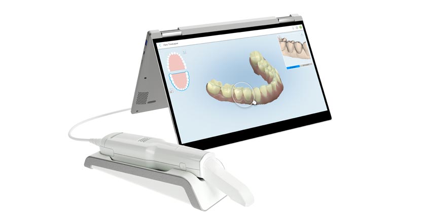 Align lance iTero Element 2 et iTero Flex – DENTISFUTURIS